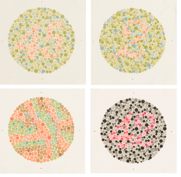 Anomalous colour vision : Achromatopsia and Dyschromatopsia