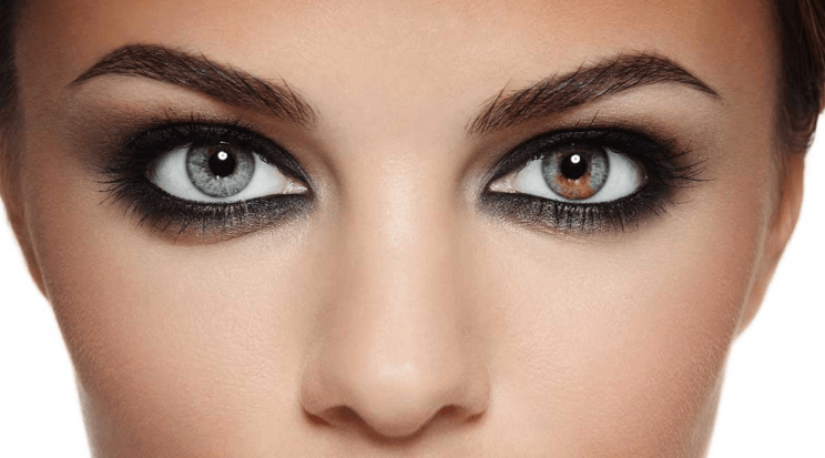 Hétérochromie ou yeux vairons - ICR Centre Ophthalmologique