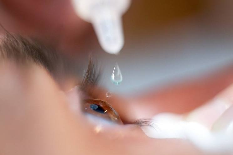 Ojo rojo: ¿es una urgencia? Causas y remedios | ICR