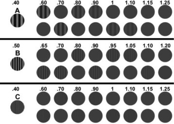 Test de Sensibilidad al Contraste – CSV 1000. Institut Català de Retina