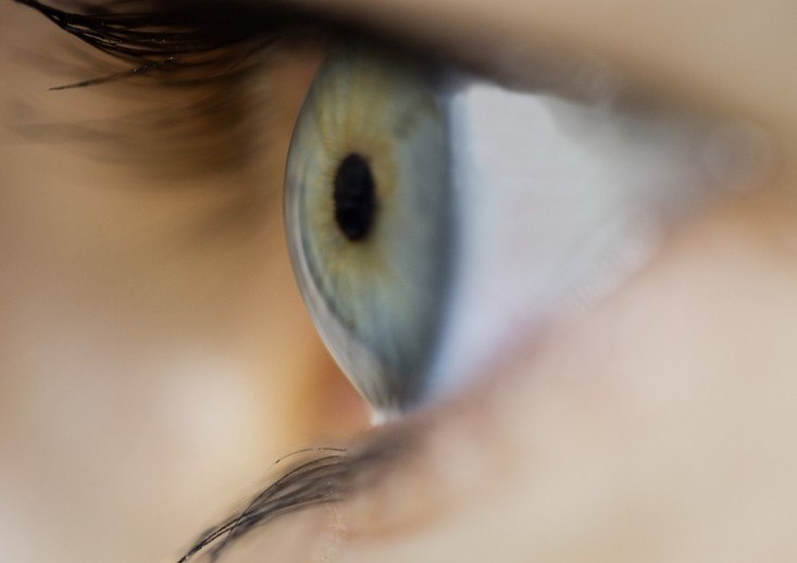 Refractive surgery: myopia, hyperopia, astigmatism or presbyopia