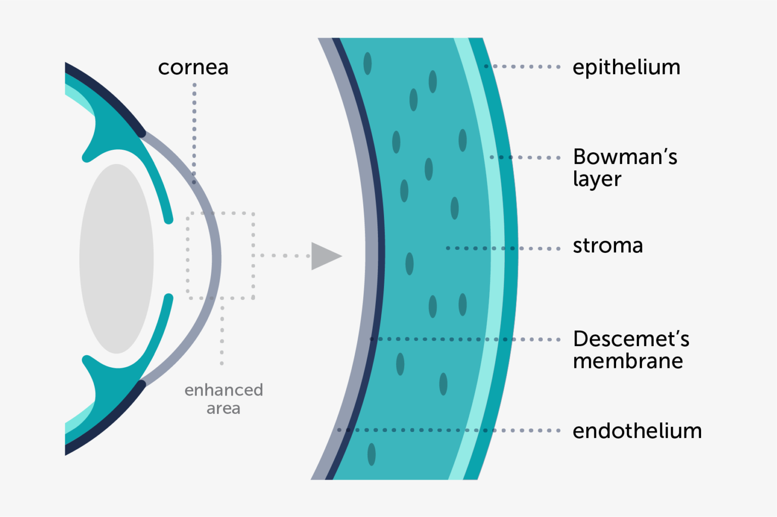 What are corneal dystrophies | ICR Ophthalmological Centre